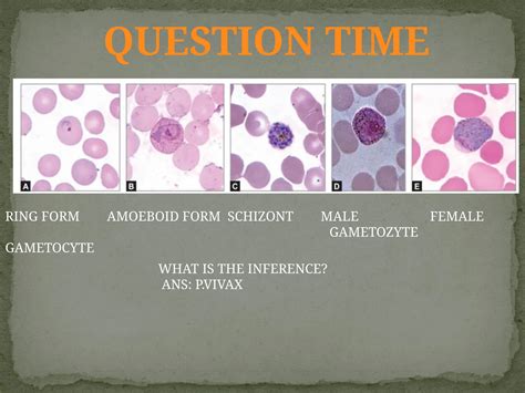 Malaria Life Cycle Patho Physiology Lab Diagnosis Pptx