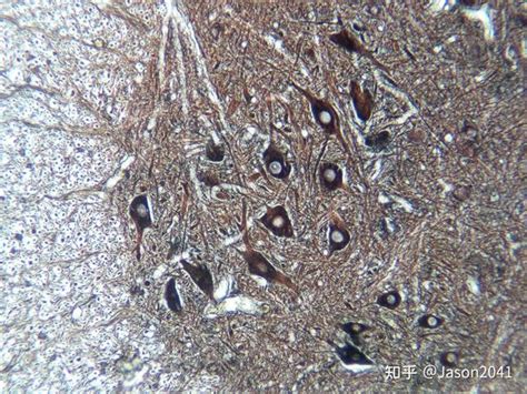 神经组织i 光镜下显示正常神经元和胶质细胞的方法 知乎