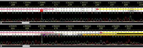 Case 4 Insertion Of An Adenine In Exon 24 Of Nf1 C31933194insa