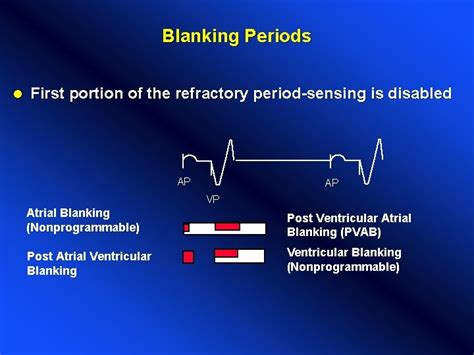 Pacemaker Timing And Intervals Objectives L L L