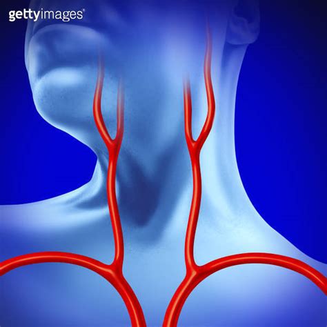 Human Carotid Artery 이미지 2154803582 게티이미지뱅크