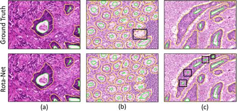Visual Results Of Gland And Lumen Segmentation Using Our Proposed