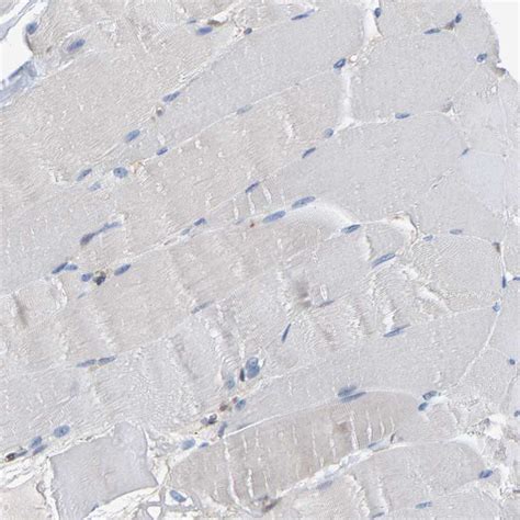 Rabbit Polyclonal Anti Mtpn Antibody Buy For Research Highly