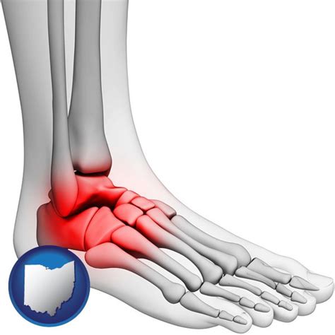 Foot And Ankle Surgeons In Ohio