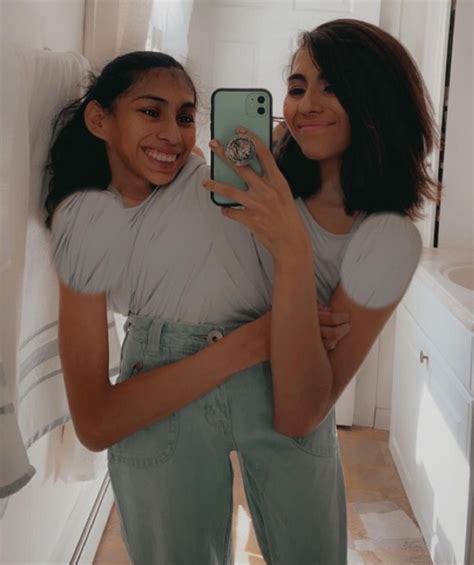 تصاویر پاسخ دوقلوهای به هم چسبیده مشهور به سؤالات عجیب مردم درباره زندگی اشتراکی شان