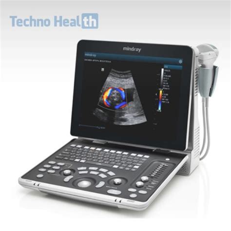 Chison CBit Ultrasound Techno Health