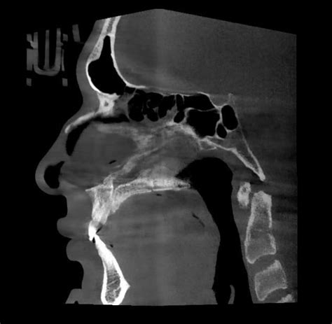 Have No Idea How To Read These Things Does My Recession Look Bad