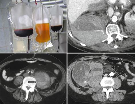 Sign Radiology Key