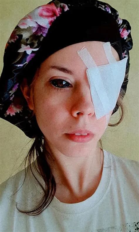 Fanka Popka Aleksandra Gałuszka wygrała proces o utratę wzroku po