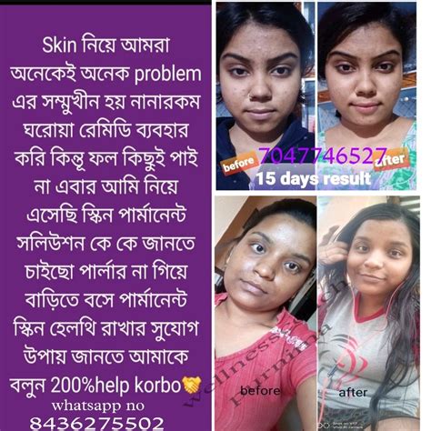 Purnima Biswas Posted On Linkedin