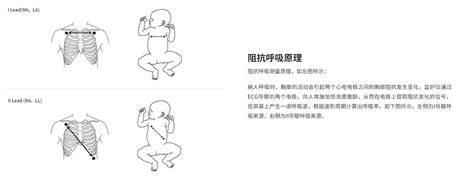 iRealRESP 呼吸频率技术