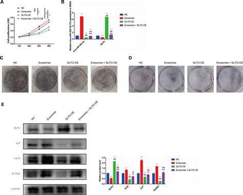 Slit2 Mediated The Pro Osteogenic Function Of Mir 382 In Hbmsc Sev A