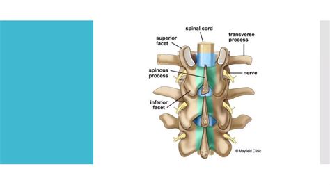 Deformities Of Spine Pptx