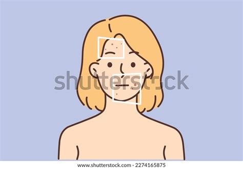 Naked Woman Red Pimples On Face Stock Vector Royalty Free Shutterstock