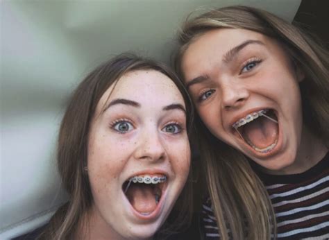 Cute Braces Pic In 2025 Braces Girls Cute Braces Braces And Glasses
