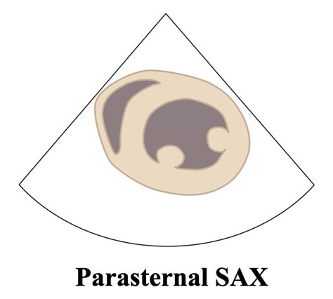Tte Probe Motions And Basic Exam