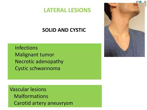 Diagnosis Of A Cervical Tumefaction F Heran Ppt
