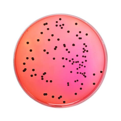 Xld Agar Composition Principle And Uses 58 Off