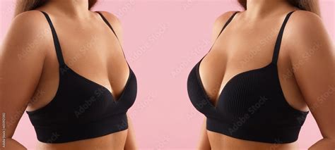 Woman Before And After Breast Augmentation On Pink Background Closeup