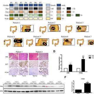 Clinical Data Of The Seven CRC Patients A Clinical Analyses Of Seven Download Scientific