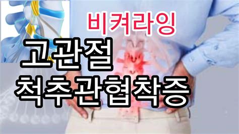 엉덩이근육 고관절 척추측만증 허리디스크 최고의 속근육키우는운동법~~~ Youtube