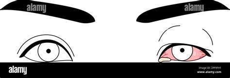 Medical Clipart Line Drawing Illustration Of Eye Disease And Viral