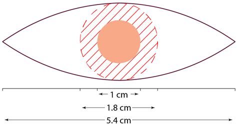 Basal Cell Carcinoma The Definitive Guide Skintel