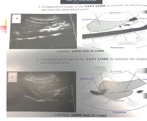 Liver Diagram Quizlet