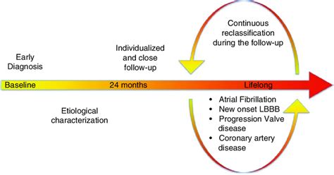 3 Key Point In Dcm Management Lbbb Left Bundle Branch Block Download