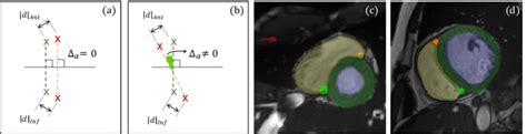 A An Example Where The Mean Distance And The Mean Angle Provide Download Scientific Diagram