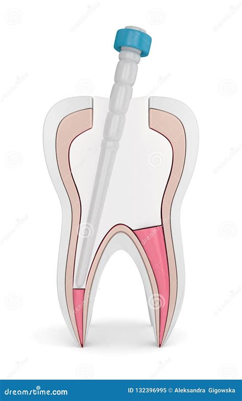Gutta Percha Pellets Linear Icon Endodontics Gutta Percha Cones In A
