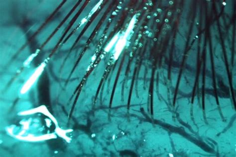 Neuralink Det Behöver Du Veta Om Hjärnimplantatet