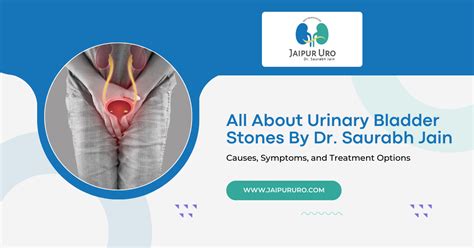 All About Urinary Bladder Stones By Dr Saurabh Jain Jaipururo