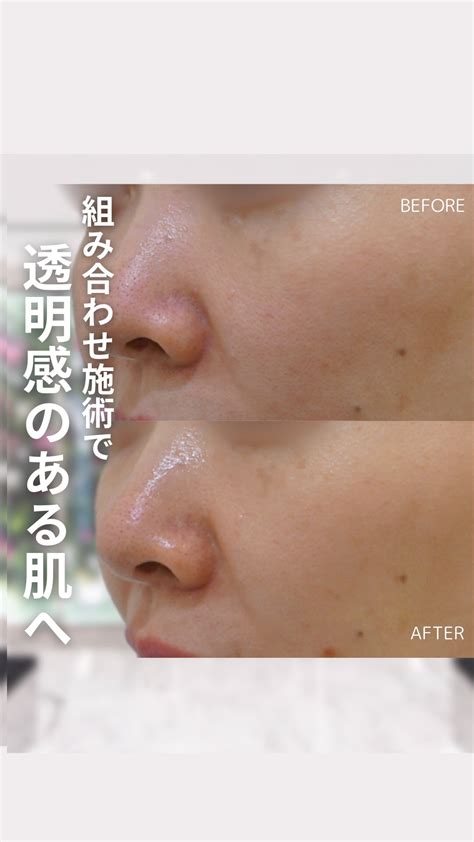 Atelier Clinic By Lesthetic 年末年始におすすめな美容医療3選！ Ateliermedical