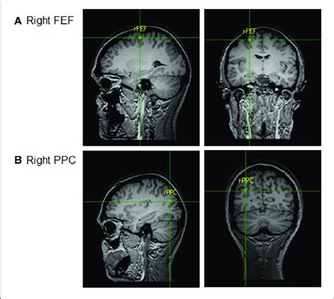 Locations Of Tdcs Sites A Right Fef And B Right Ppc Download