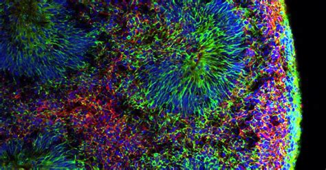 Tiny Brains In A Dish Could Finally Uncover The Long Standing Mysteries Of Psychedelics R