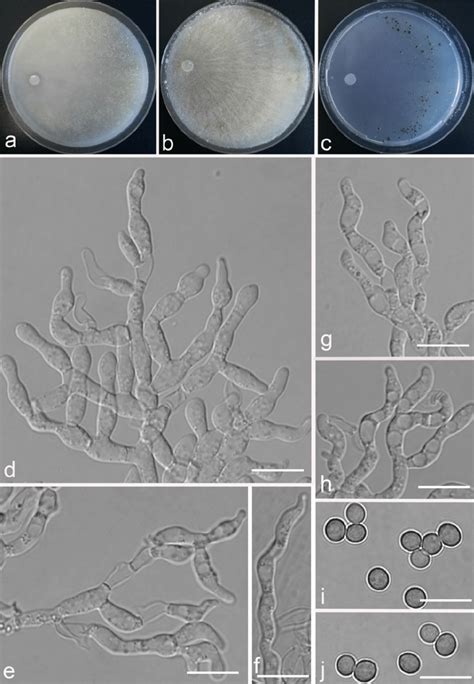 Trichoderma Asymmetricum Ymf 1 04618 A C Cultures After 7 D At 25 Download Scientific