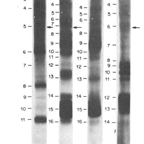 A D Shows The Comparison Of Electrophoretic Protein Patterns Of Ovary
