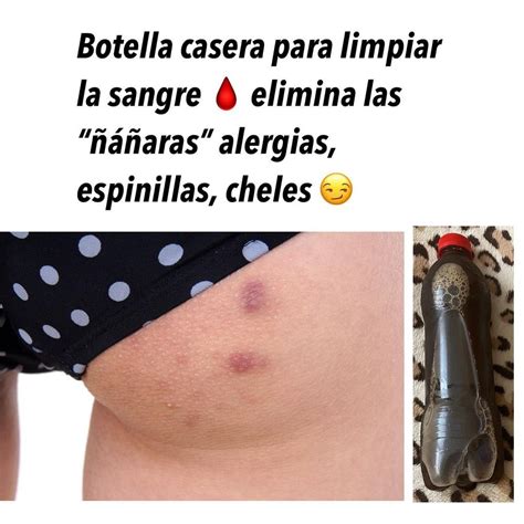 434 Me Gusta 12 Comentarios Remedios Para Ti Remedioscaserosparati