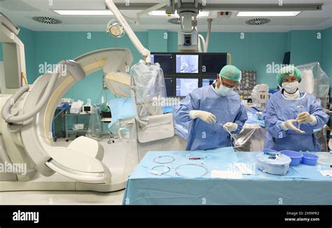 Cerebral Aneurysm Embolization Angiography System Interventional