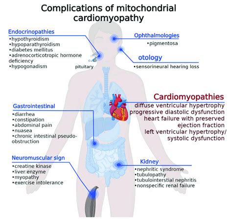 Common Complications Of Mcm Mcm Patients Can Present A Range Of