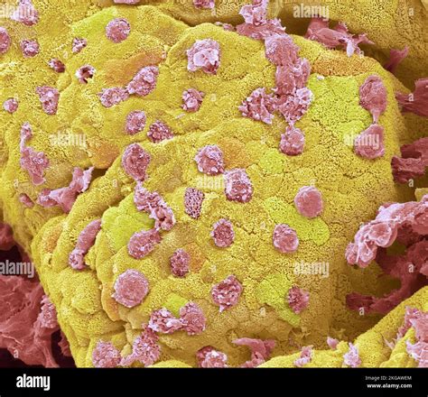 Colon Colour Scanning Electron Micrograph Sem Of The Wall Of The Human Large Intestine Colon