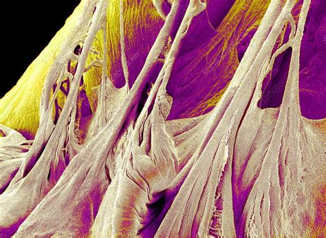 Heart Valve And Strings SEM Stock Image C022 9037 Science Photo