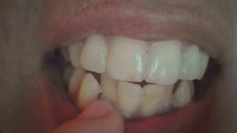 Ginarys Giantess Adventures Mouth Inspection With Star Morning Wmv
