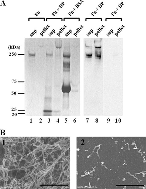 Determination Of The Binding Sites Of Fn With Dp A Screening Of Fn