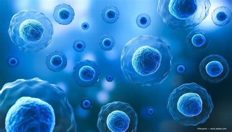 A Guide To Treating Severe Ocular Graft Vs Host Disease
