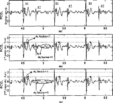 Figure 1 From Detection Of The First Heart Sound Using A Time Delay Neural Network Semantic