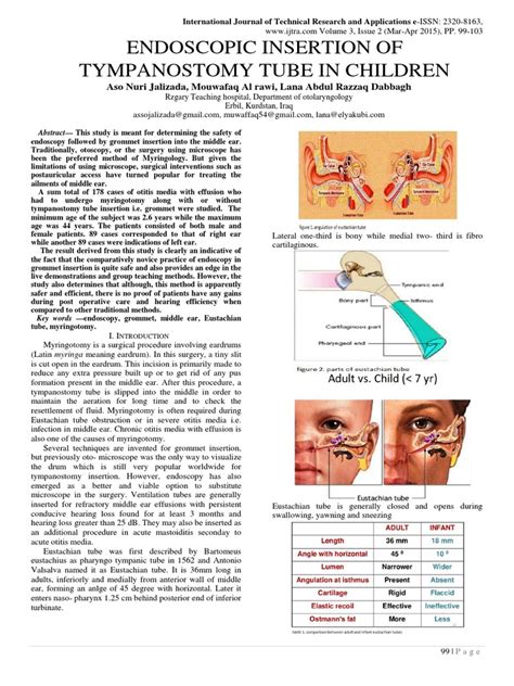 Myringotomy With Grommet Insertion Warehouse Sale