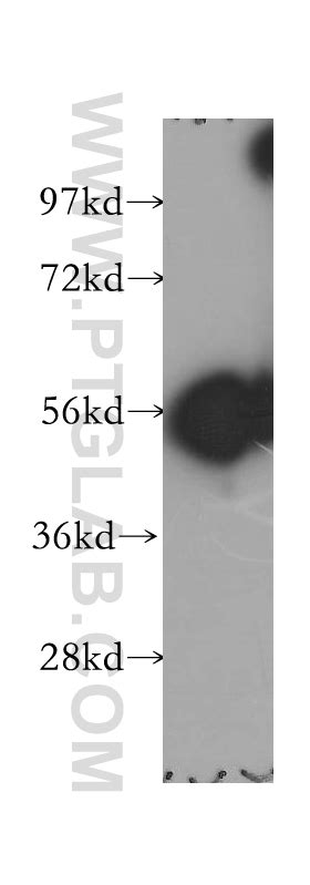 Glyctk Antibody 12426 1 Ap Proteintech 武汉三鹰生物技术有限公司