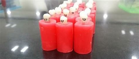 Teeth Mounted On A Custom Made Wax Block Standardised Class V Cavities